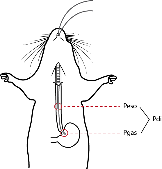 Millar Pressure Catheter | Airway, Spinal, and Tumor Pressure Measurement | ADInstruments